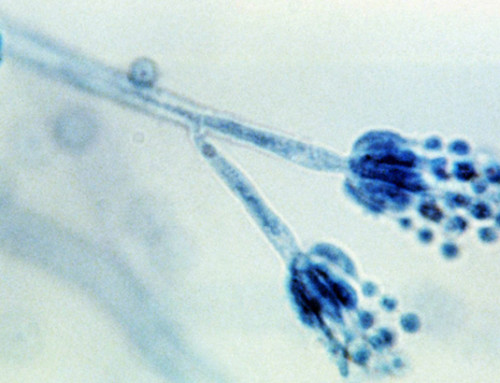 Hand Dryer vs. Paper Towel: Who Wins the Bacteria Battle? - Precision ...